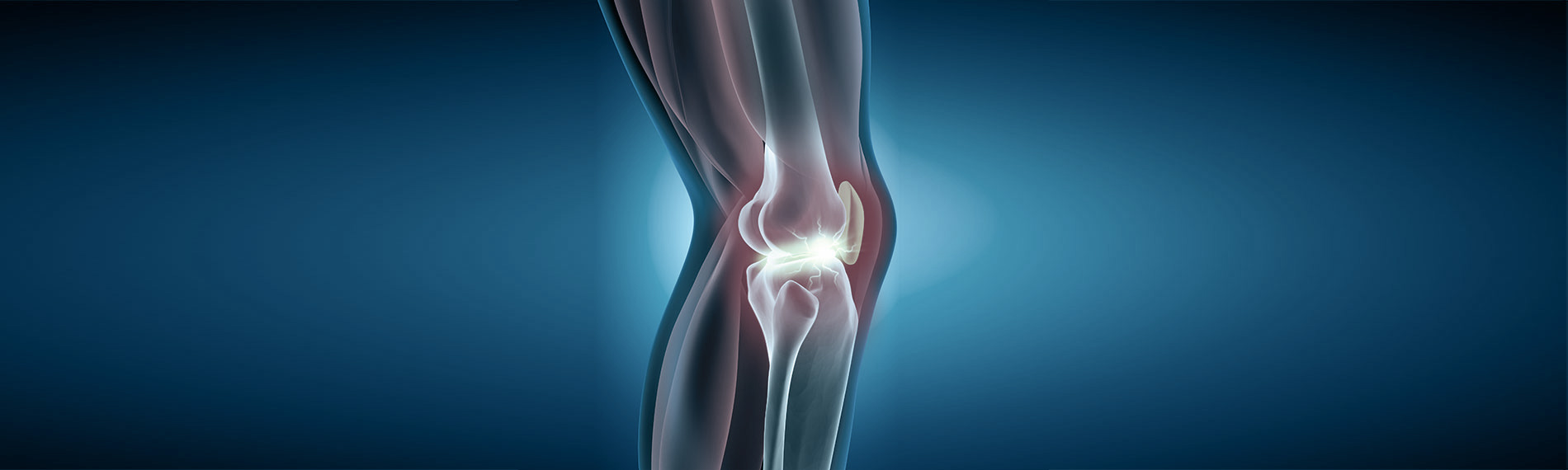 Pathologies ménisco-ligamentaires - Chirurgie Orthopedique Valence