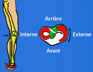 Lésions méniscales - Chirurgie Orthopedique Valence